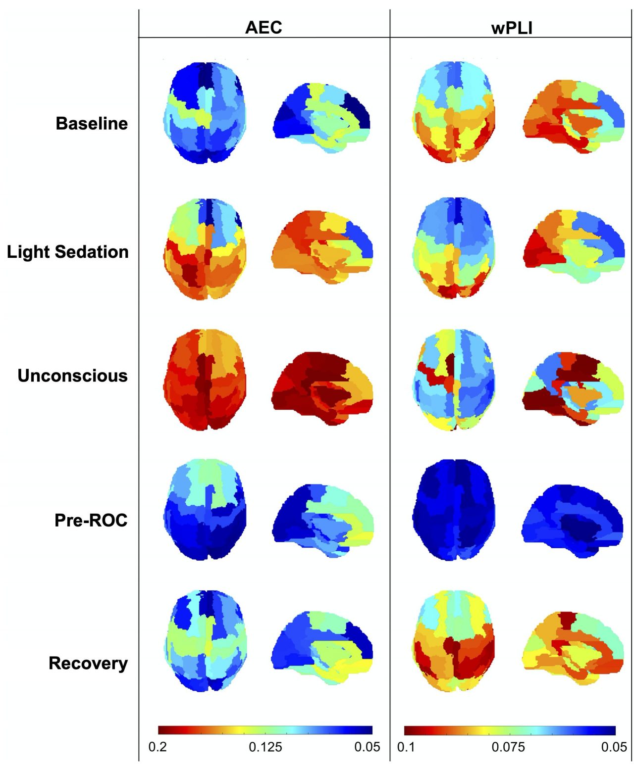 Neural Correlates of Consciousness | BIAPT